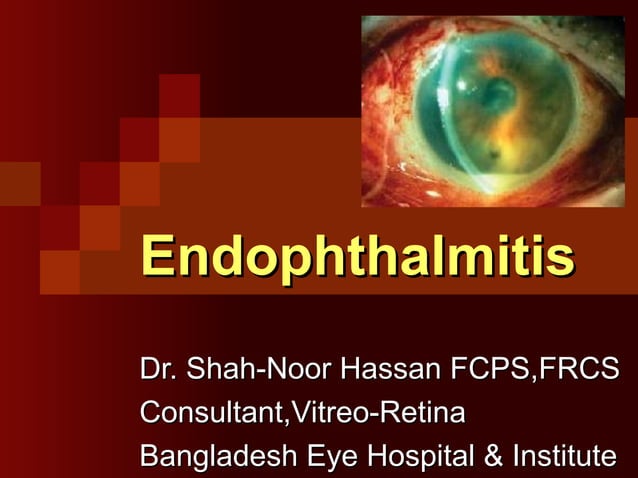 Endophthalmitis | PPT