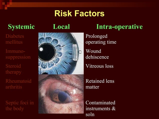 Endophthalmitis | PPT