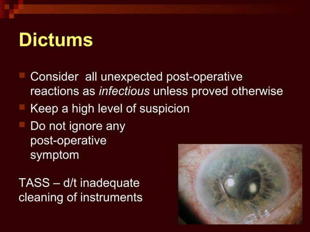 Endophthalmitis | PPT