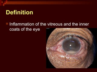 Endophthalmitis