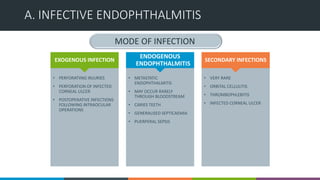 Endophthalmitis | PPTX | Eye and Vision Conditions | Diseases and ...