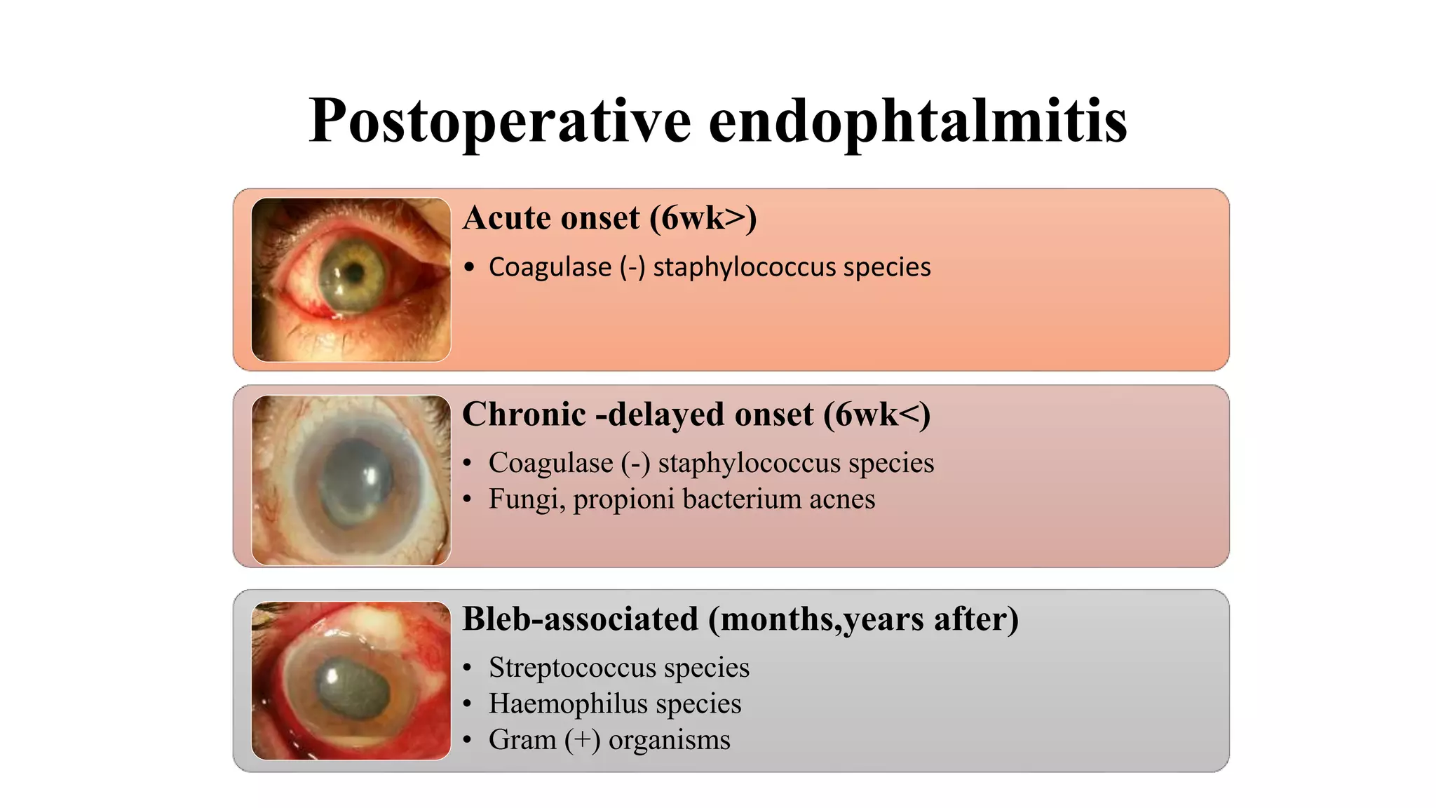 Endophthalmitis | PPTX