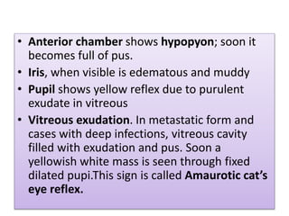 ENDOPHTHALMITIS.PRABIN.pptx