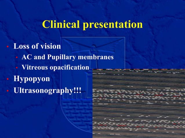 Endophthalmitis | PPT