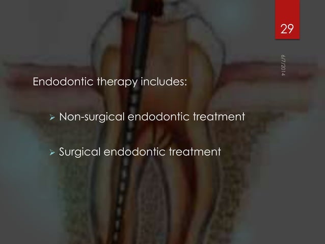 Rationals of endodontics best ppt | PPTX