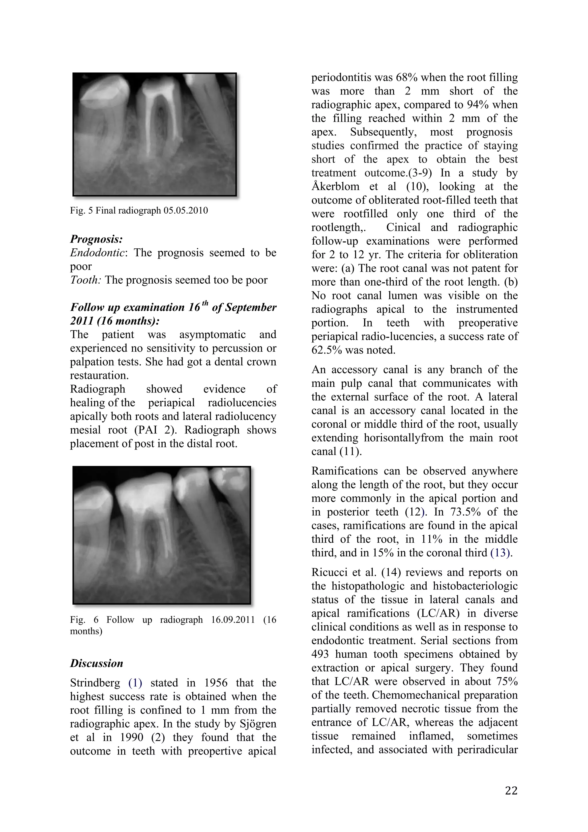 Endo protocols | PDF