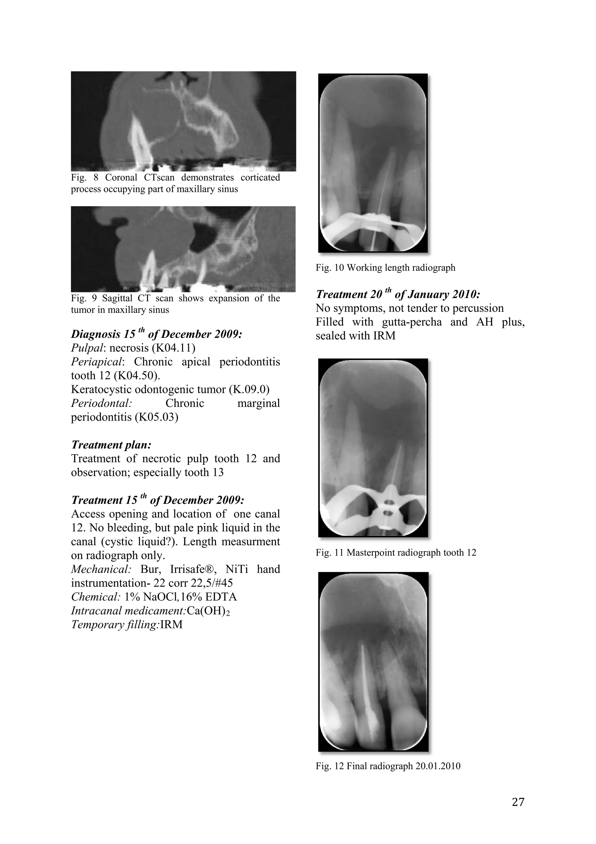 Endo protocols | PDF