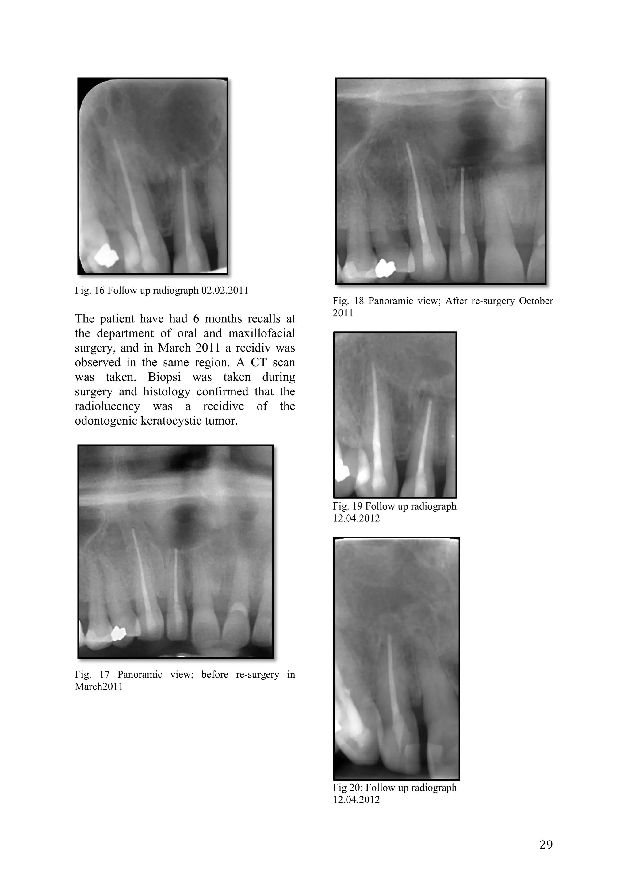 Endo protocols | PDF