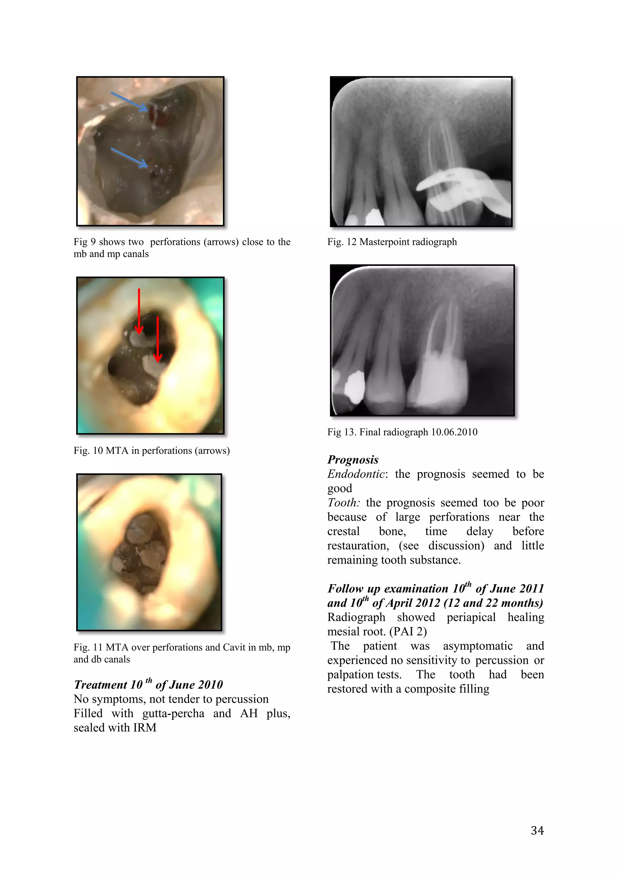 Endo protocols | PDF