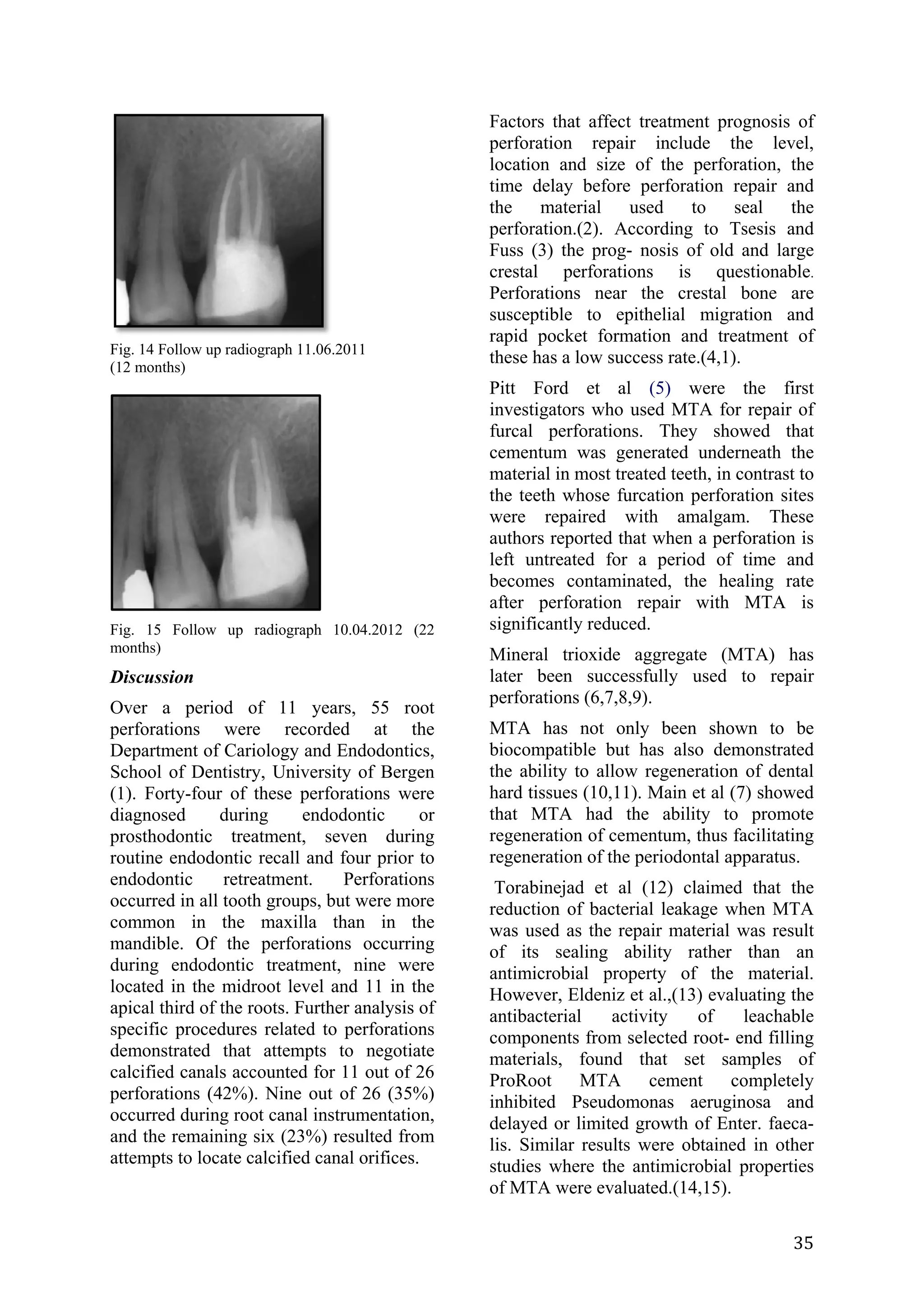 Endo protocols | PDF