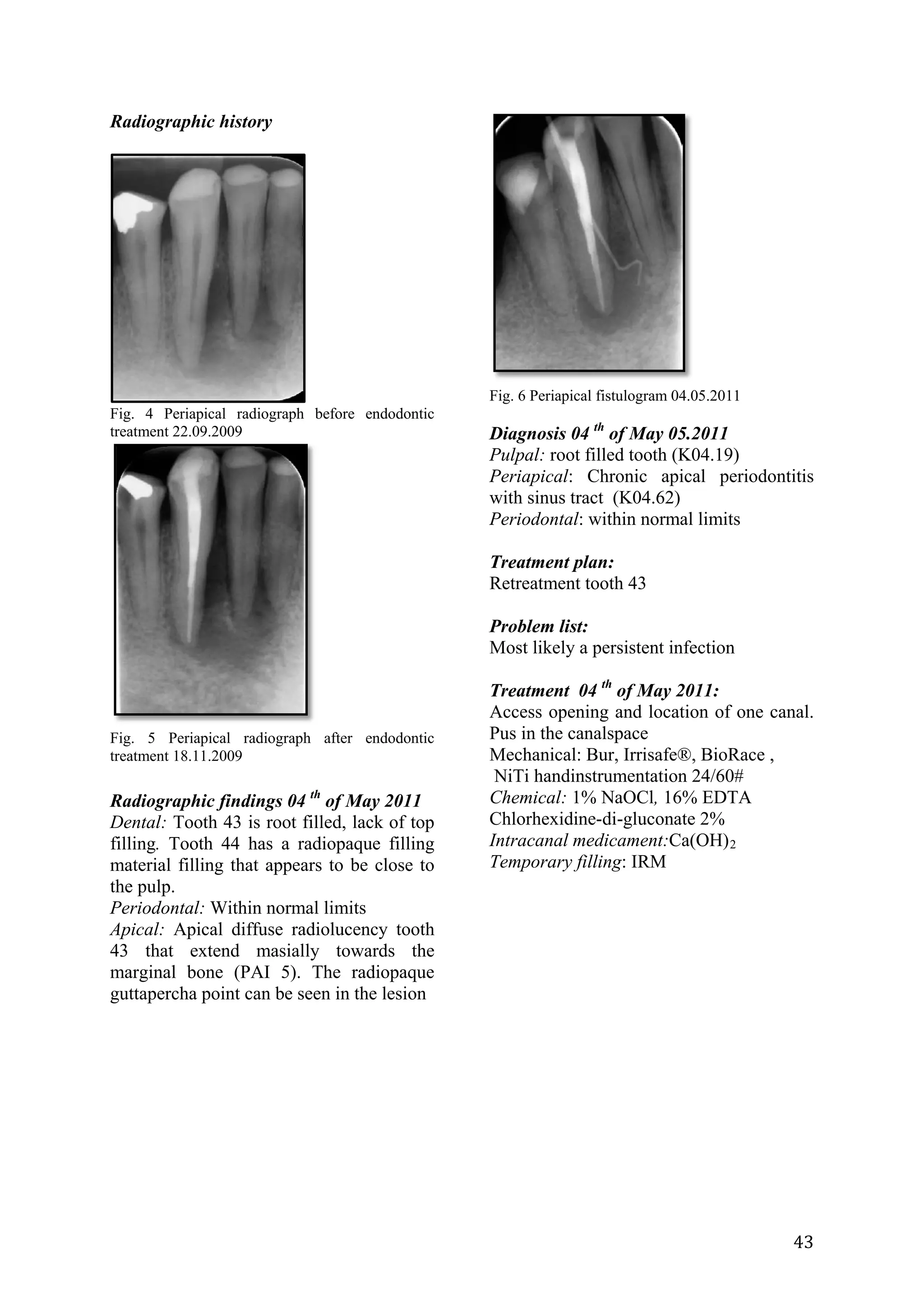 Endo protocols | PDF