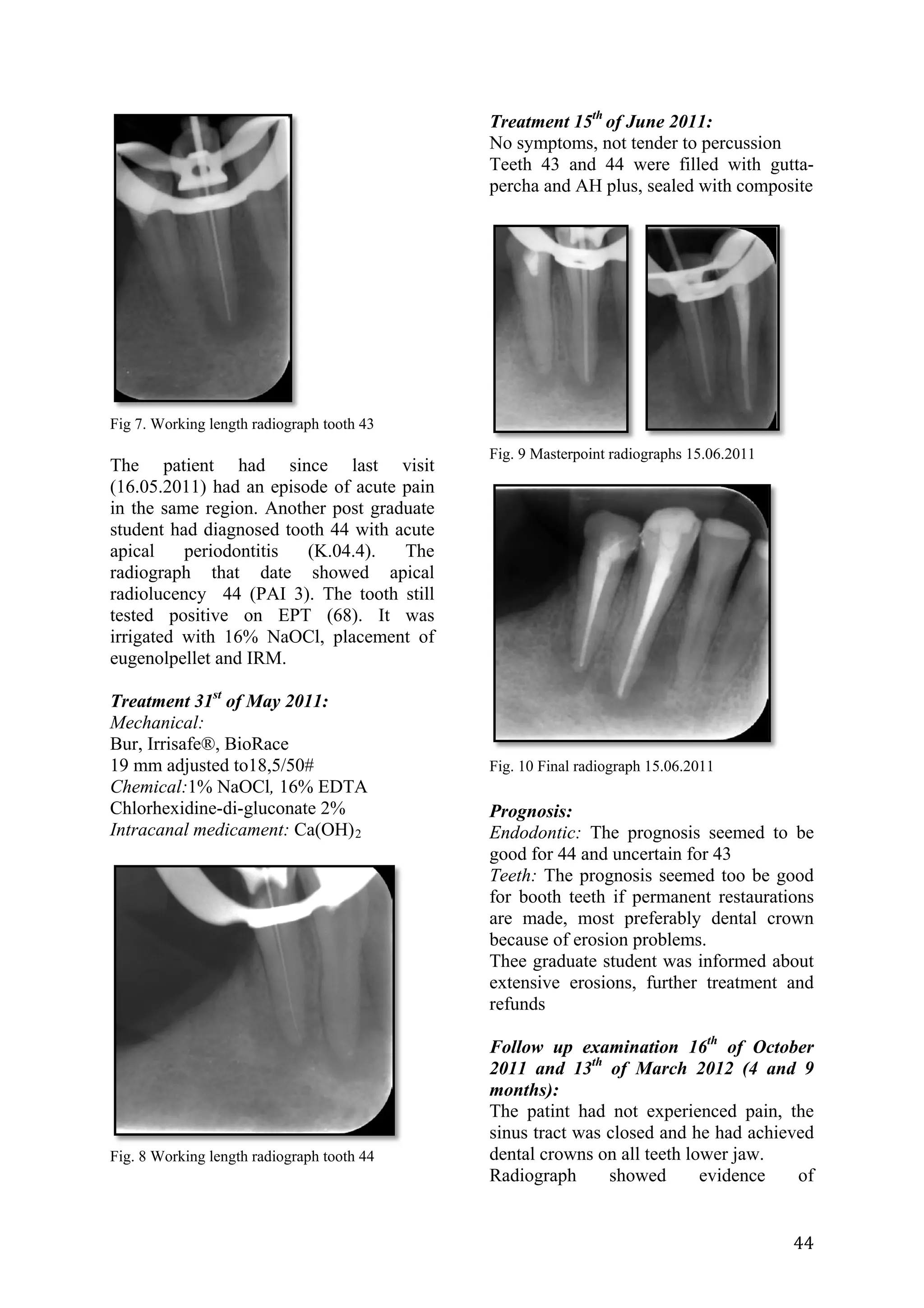 Endo protocols | PDF