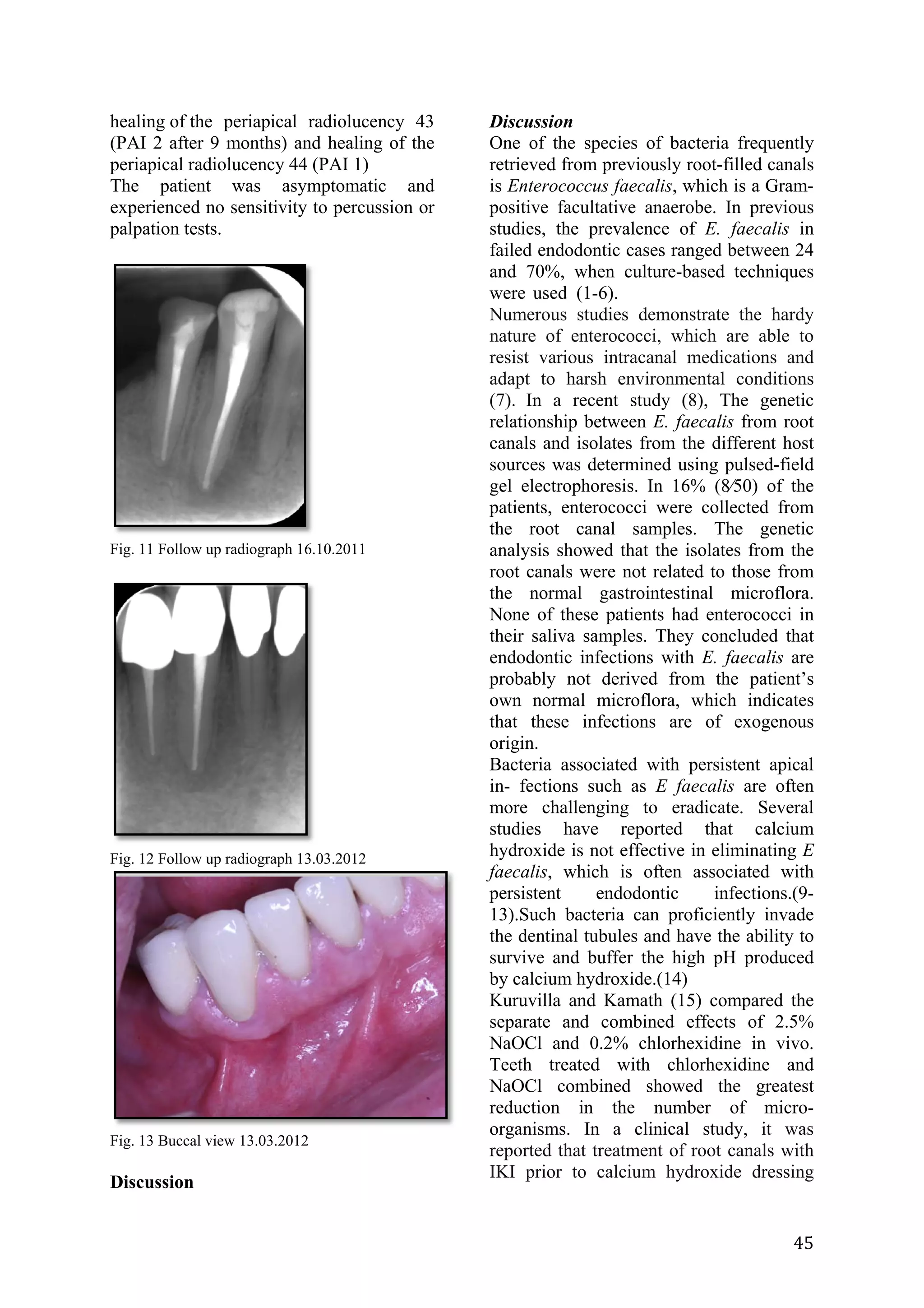 Endo protocols | PDF