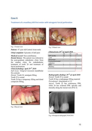 Endo protocols | PDF