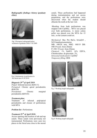 Endo protocols | PDF