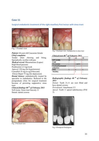Endo protocols | PDF
