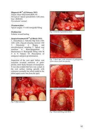 Endo protocols | PDF