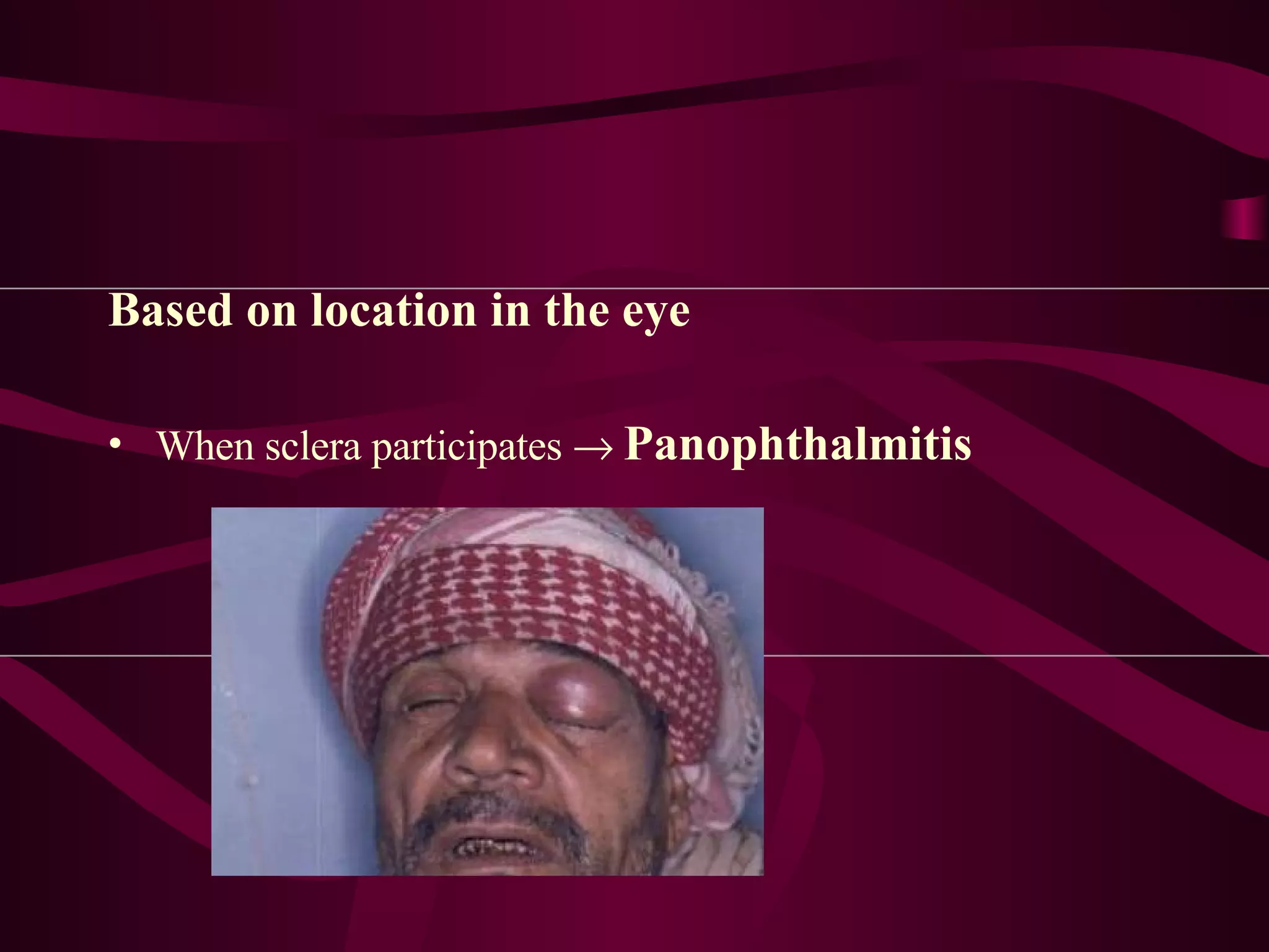 Endopthalmitis | PPT