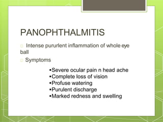 endopthalmitis-161126082828.pptx