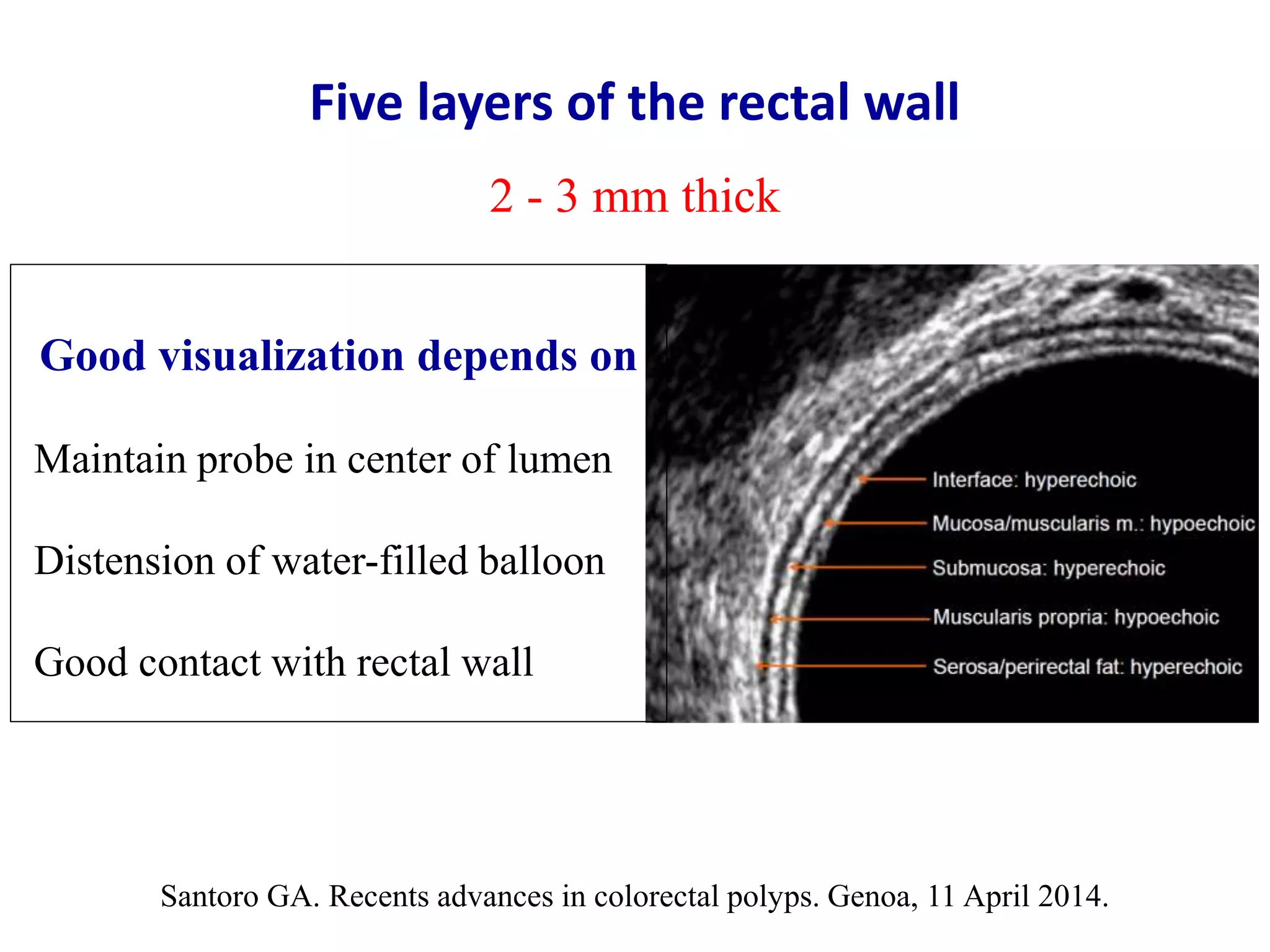 Endorectal ultrasound in rectal diseases | PPTX