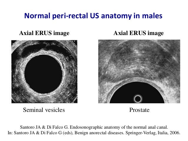 Endorectal Ultrasound In Rectal Diseases