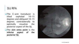 Endoscopic RF in Chronic LBP | PPT