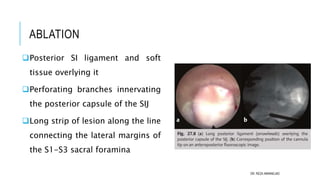 Endoscopic RF in Chronic LBP | PPT