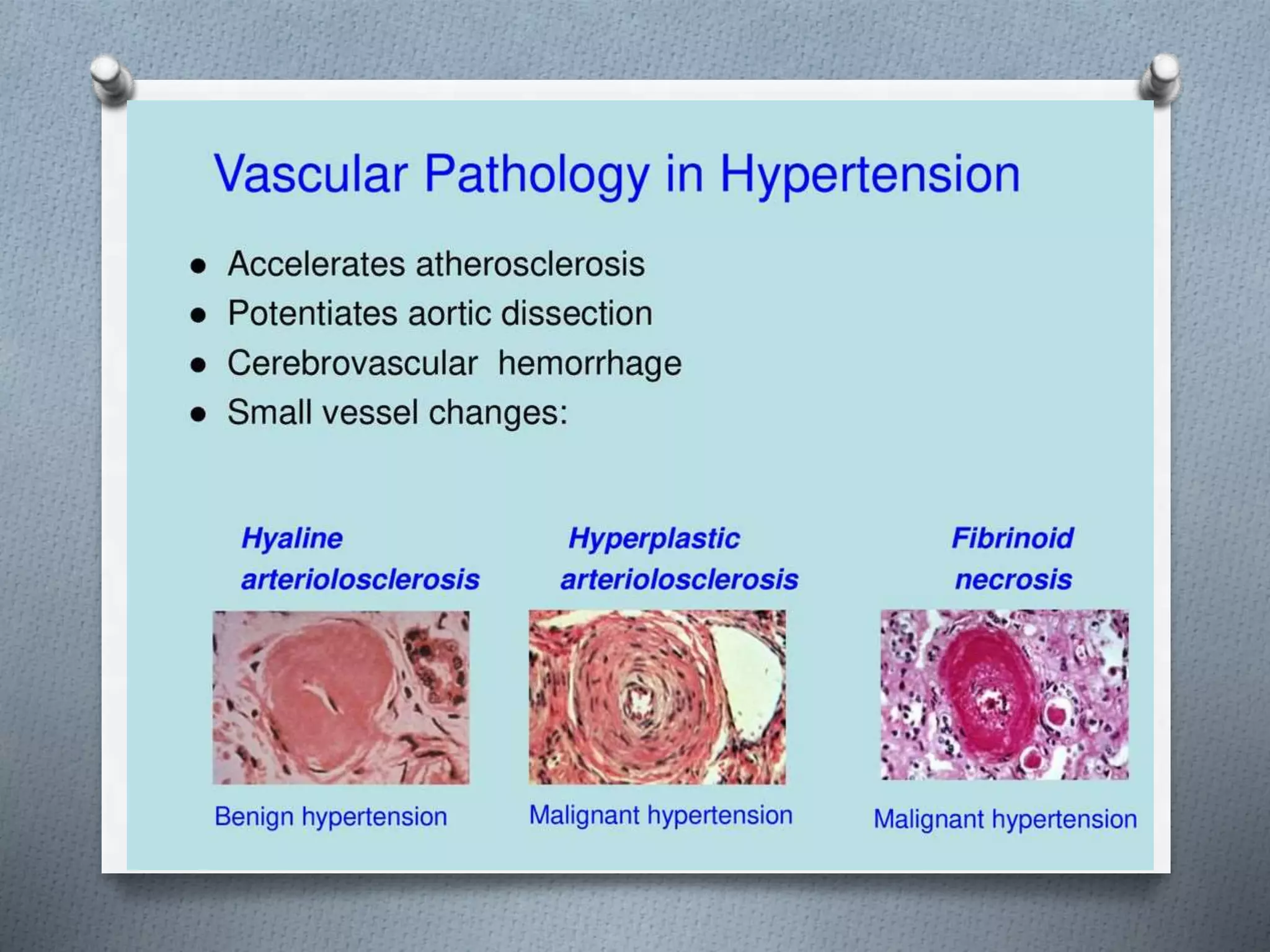 End Organ Damage In HypertensionDARB.pptx