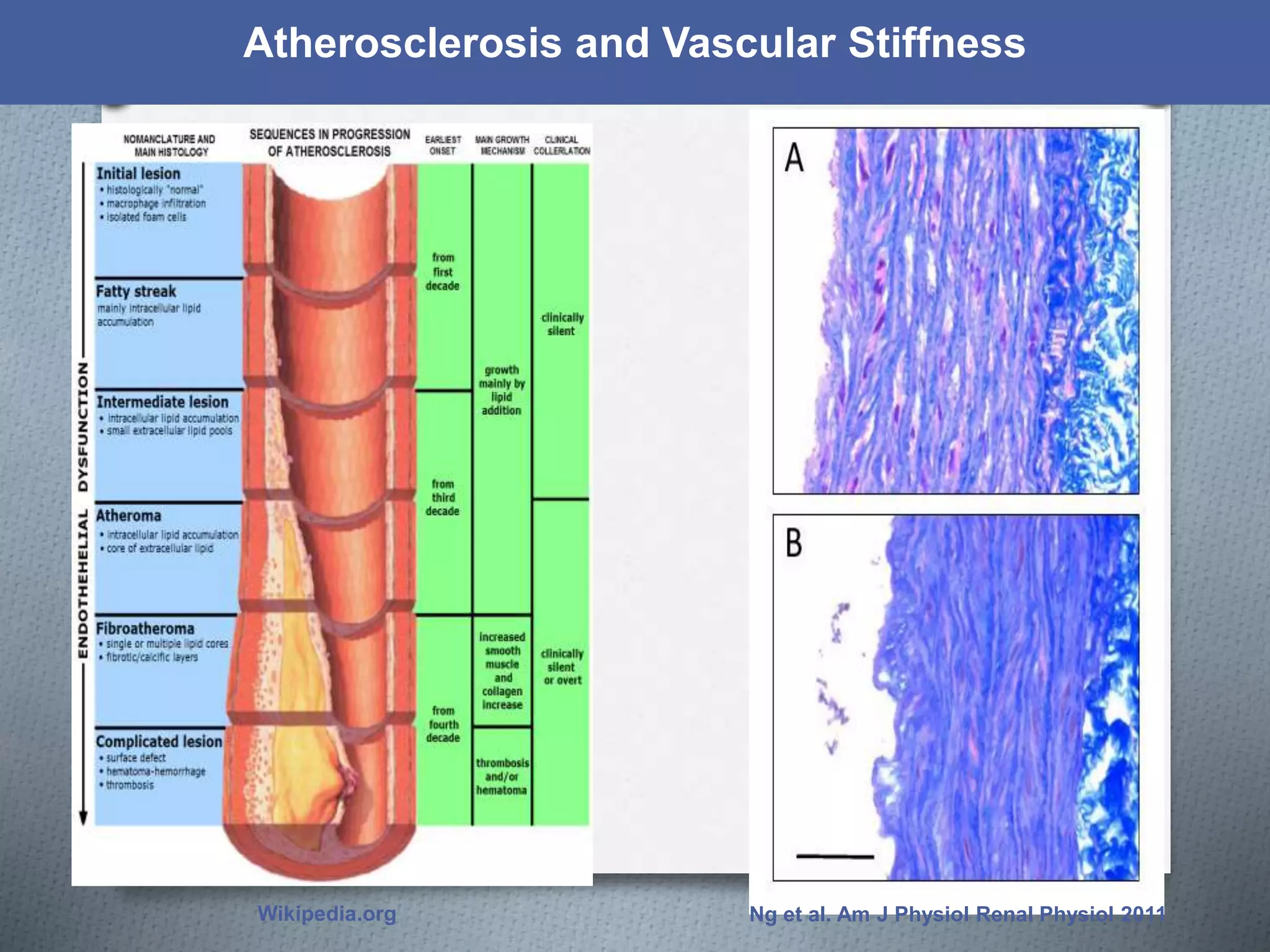 End Organ Damage In HypertensionDARB.pptx
