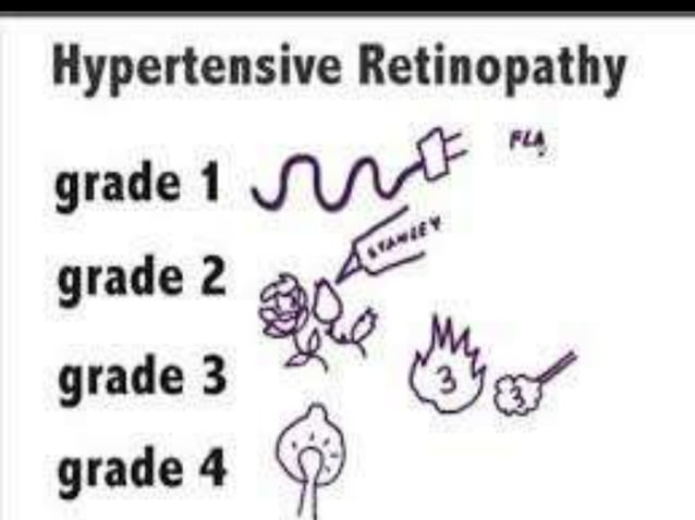 End organ damages of hypertension 2 | PPTX | Heart and Cardiovascular ...
