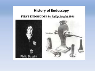 ENDOSCOPY ROLE IN INFLAMMATORY BOWEL DISEASE, ENDOSCOPY HISORY | PPTX