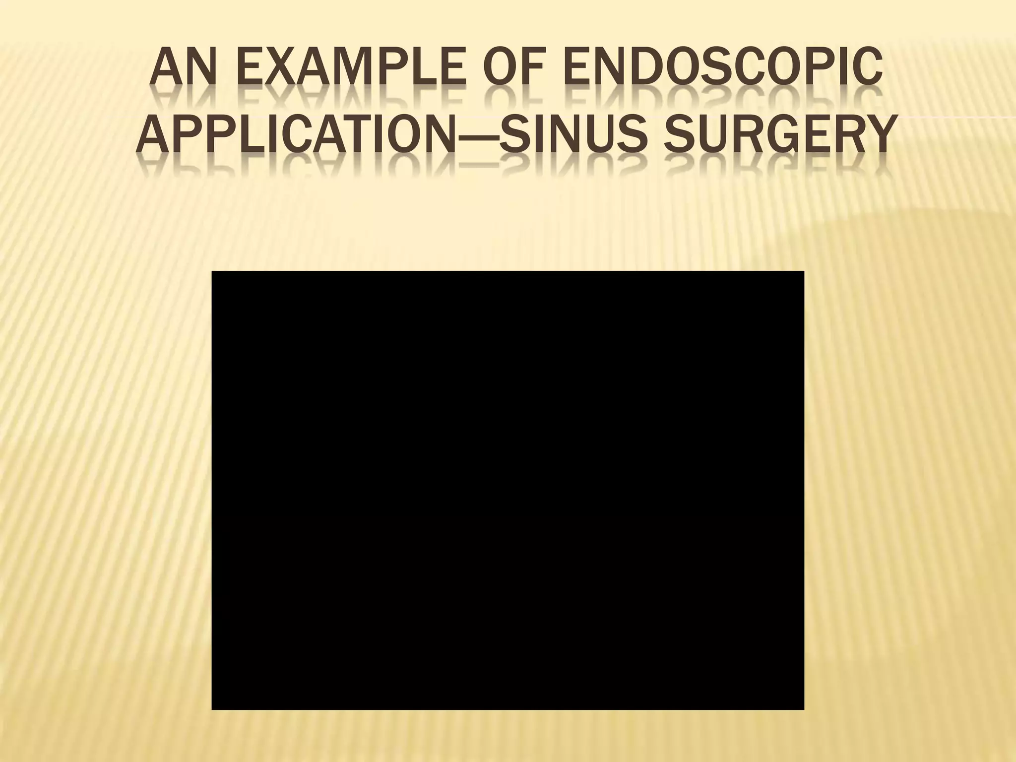 Endoscope | PPTX