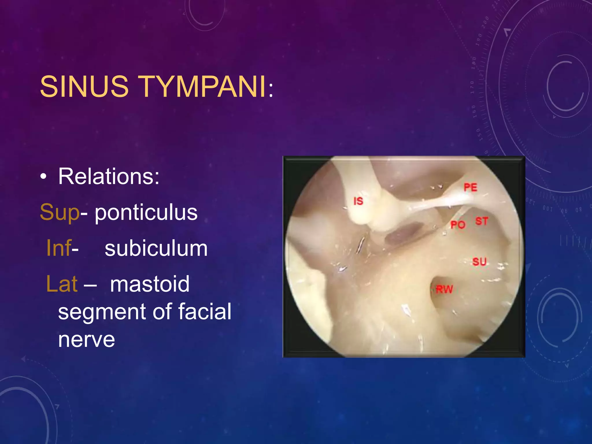 Endoscope assisted middle ear surgery | PPTX