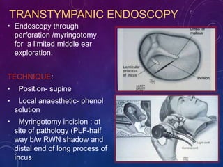 Endoscope assisted middle ear surgery | PPTX