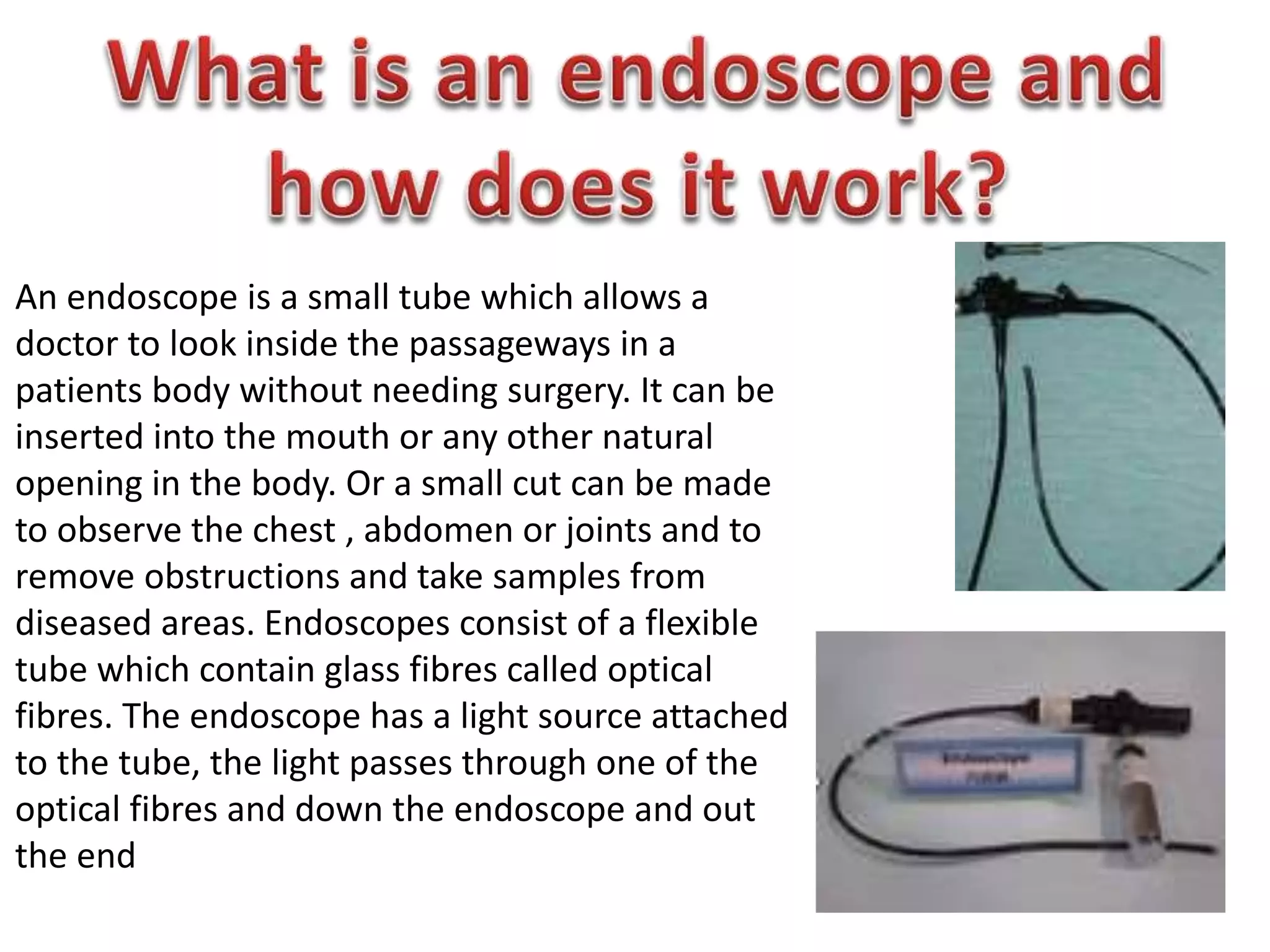 Endoscopes | PPTX