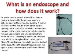 Endoscopes | PPTX