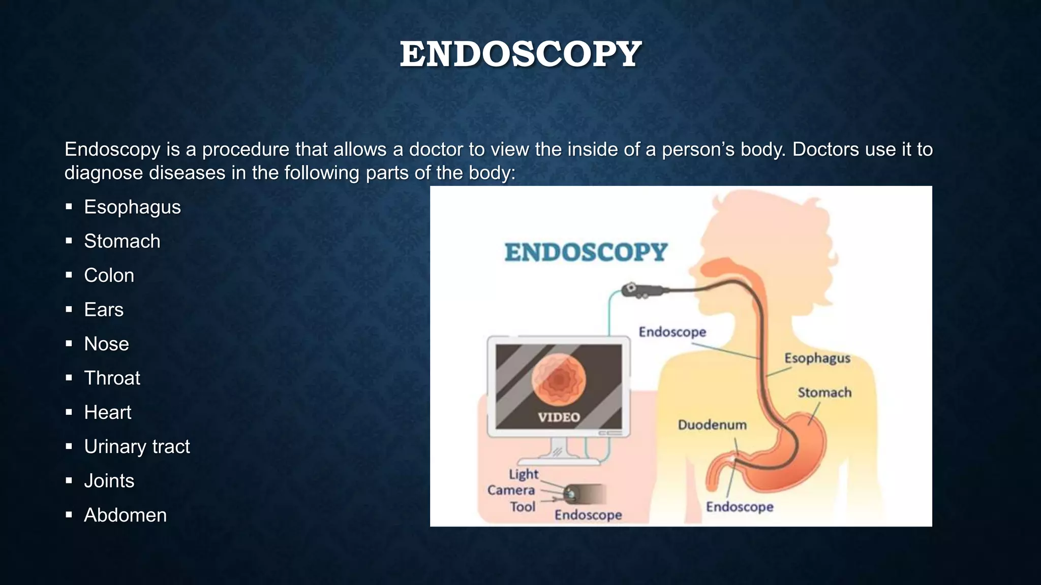 Endoscopes | PPTX | Digestive Disorders | Diseases and Conditions