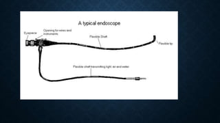 Endoscopes | PPTX