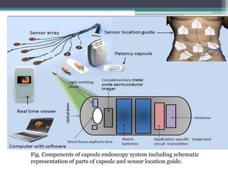 Endoscopes - Biomedical Engineering | PDF