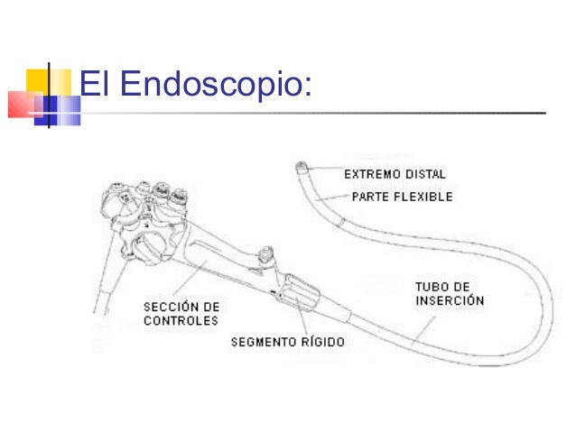 Endoscopia 2