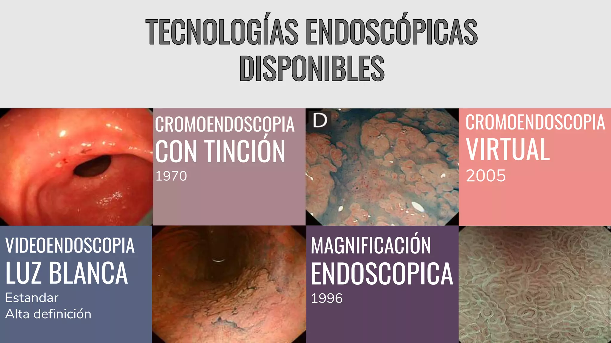 Endoscopia avanzada gastrica | PPT