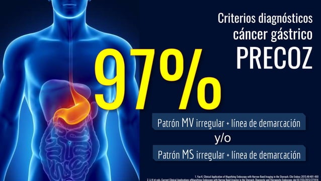 Endoscopia avanzada gastrica | PPT