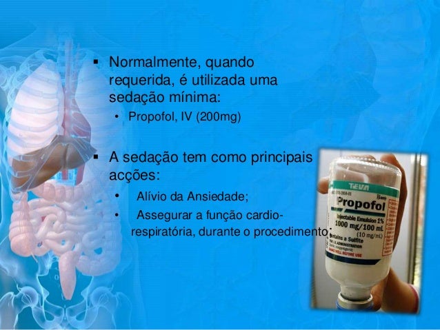 Endoscopia colonoscopia