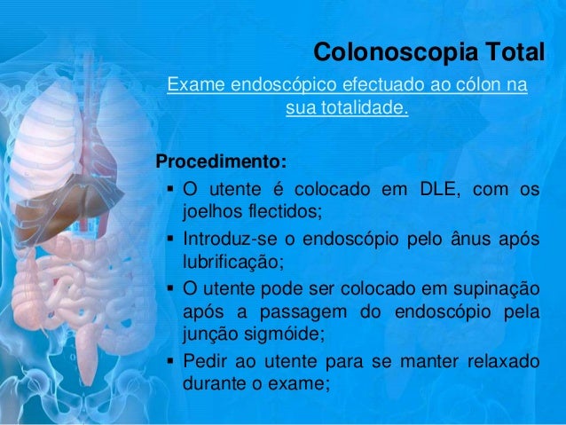 Endoscopia colonoscopia