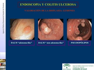 Endoscopia y cu | PPT
