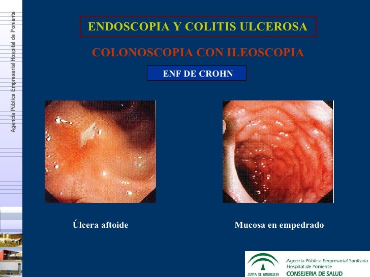 Endoscopia y cu