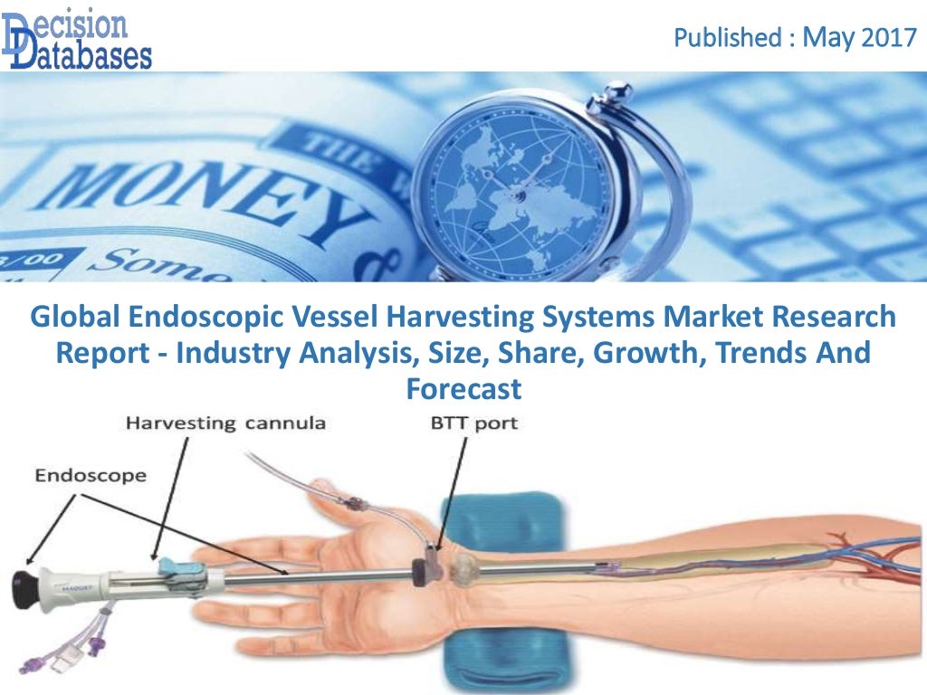Global Endoscopic Vessel Harvesting Systems Market Report Analysis Overview Global Endoscopic Vessel Harvesting Systems Market Report Analysis Overview