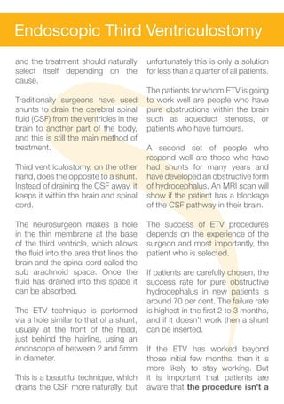 Endoscopic Third Ventriculostomy | PDF