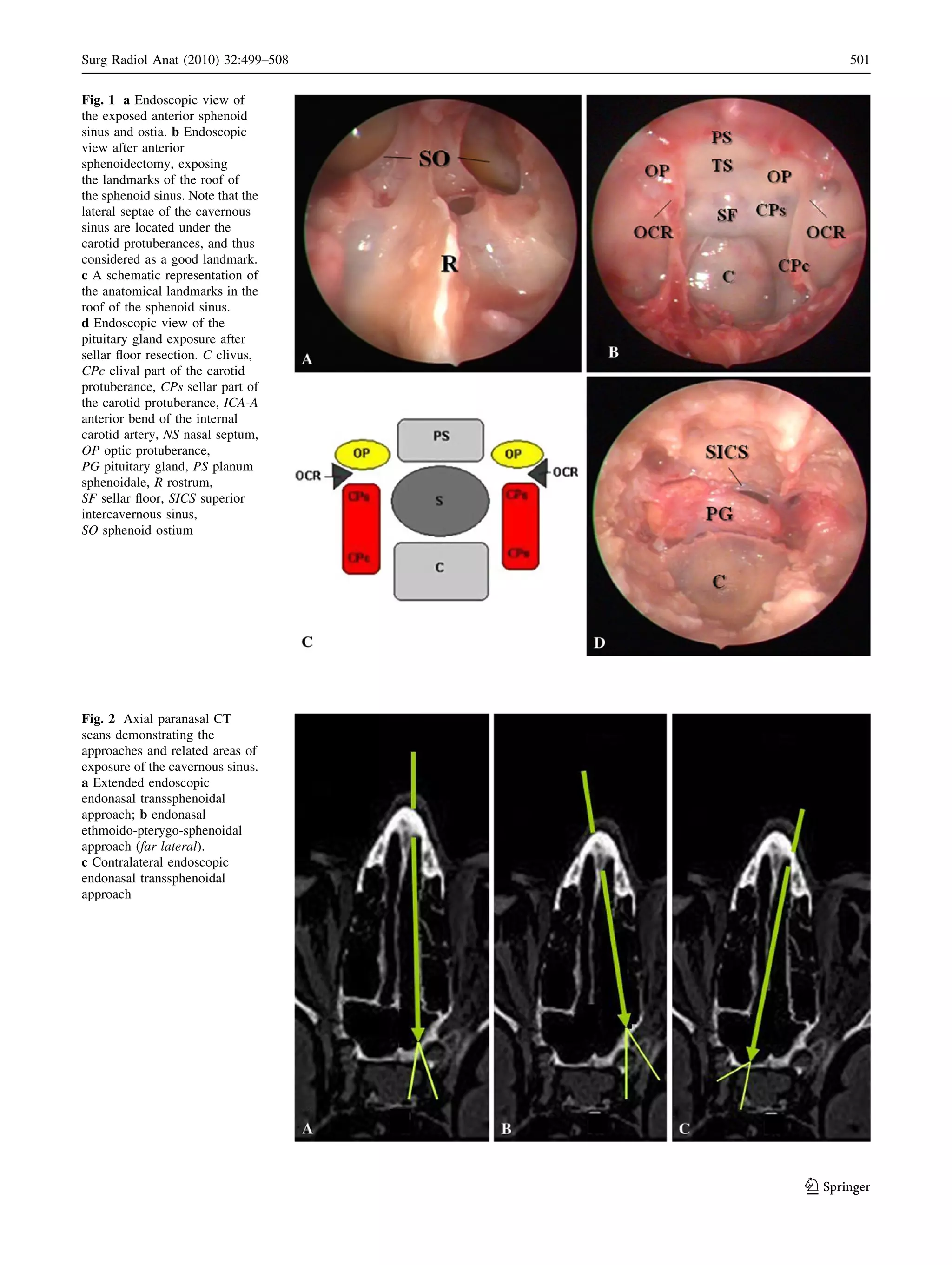 Endoscopic anatomy and approaches of the cavernous sinus cadaver study ...