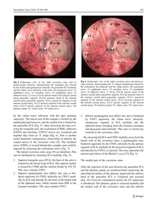 Endoscopic anatomy and approaches of the cavernous sinus cadaver study ...